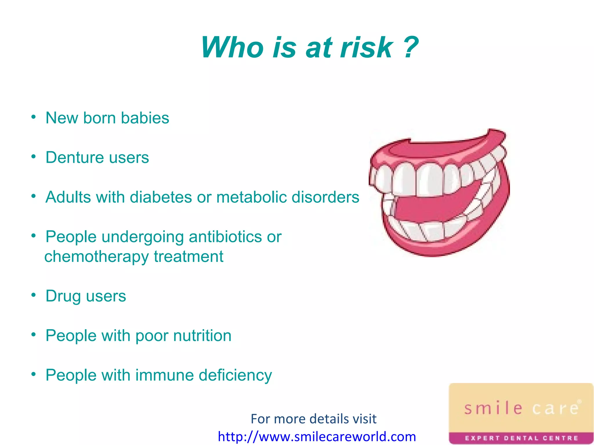Oral Thrush | PPT