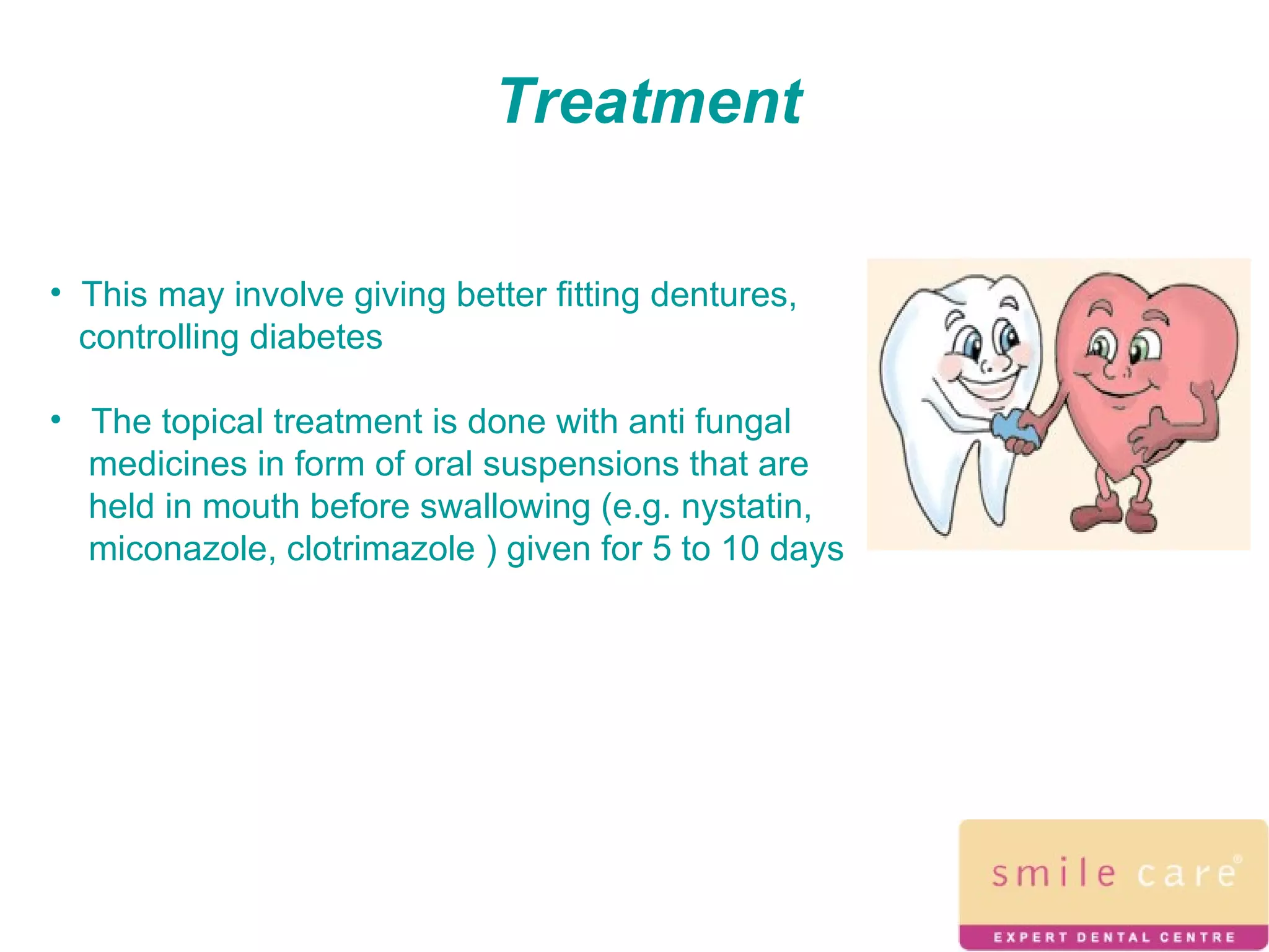 Oral Thrush | PPT