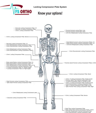 Fs ortho bone implants titanium