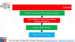 Frozen shoulder | PPTX