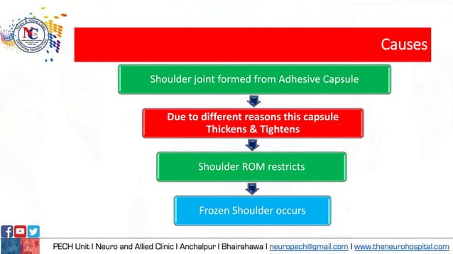 Frozen shoulder | PPT