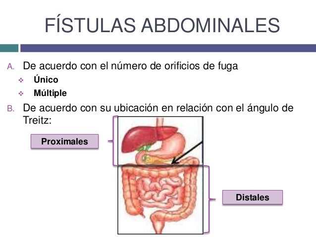 Fístulas abdominales
