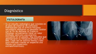 Fístulas anales | PPTX