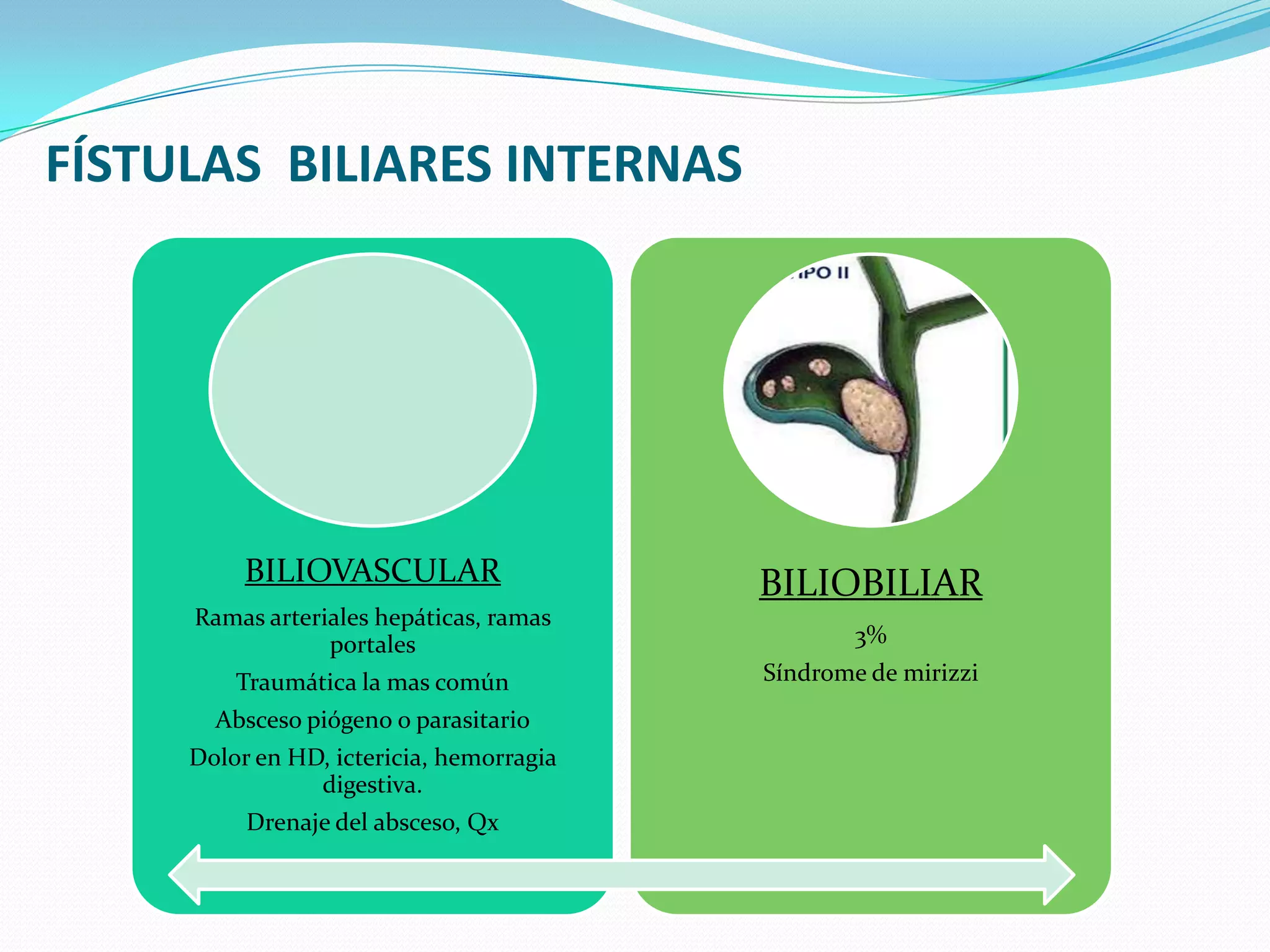 Fístulas biliares | PPTX