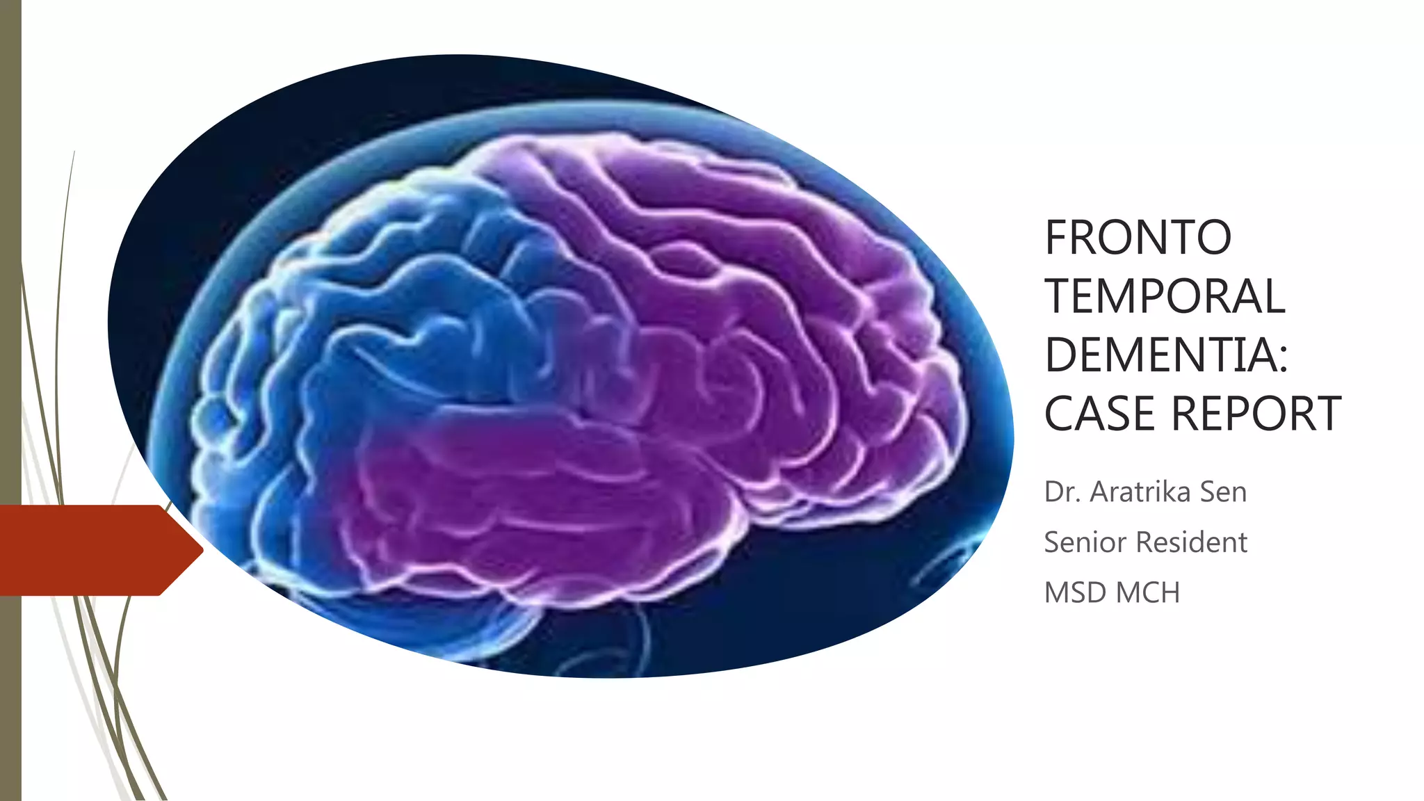 FRONTO TEMPORAL DEMENTIA | PPTX