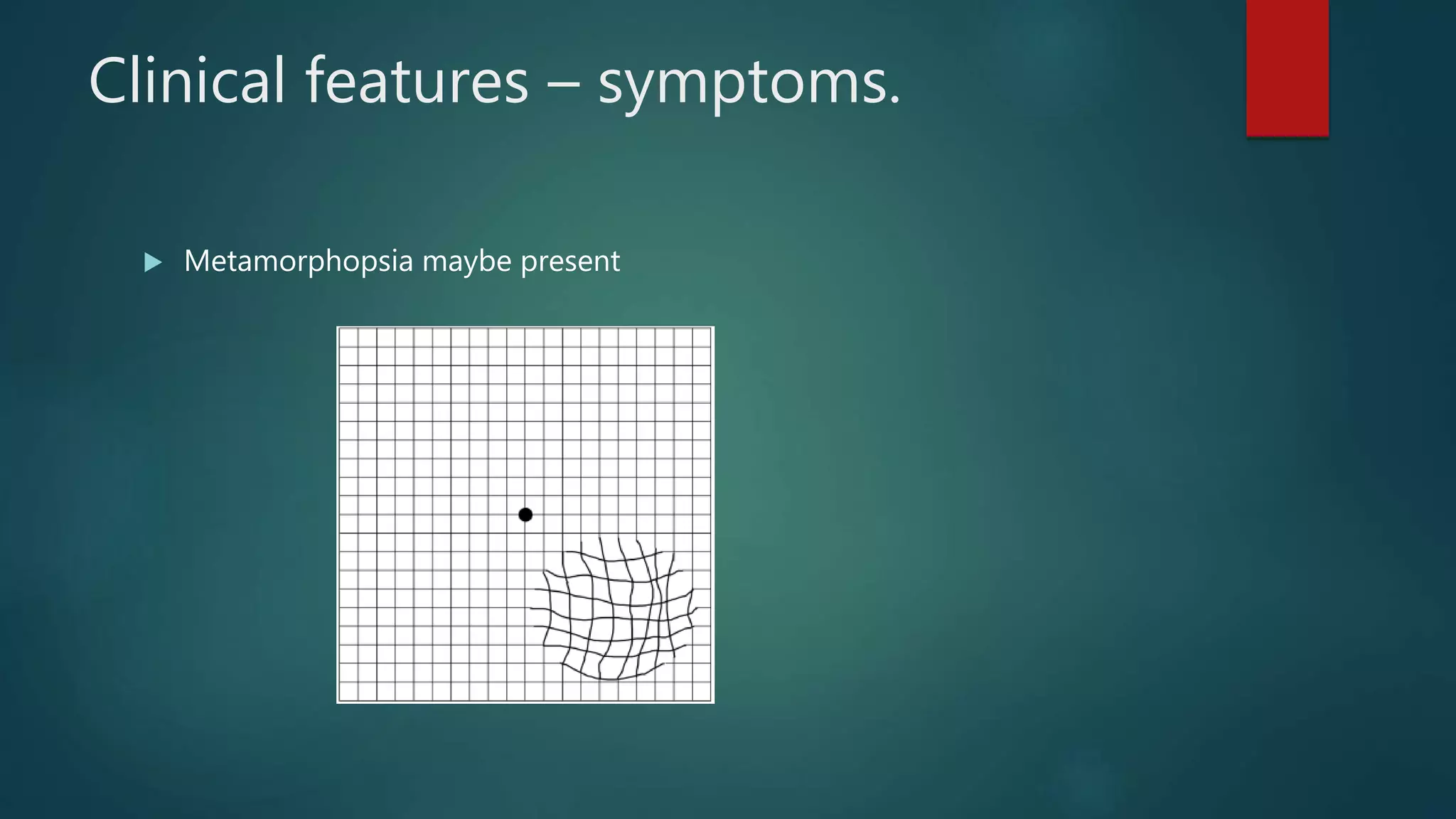 Full Thickness Macular Hole (FTMH) | PPT