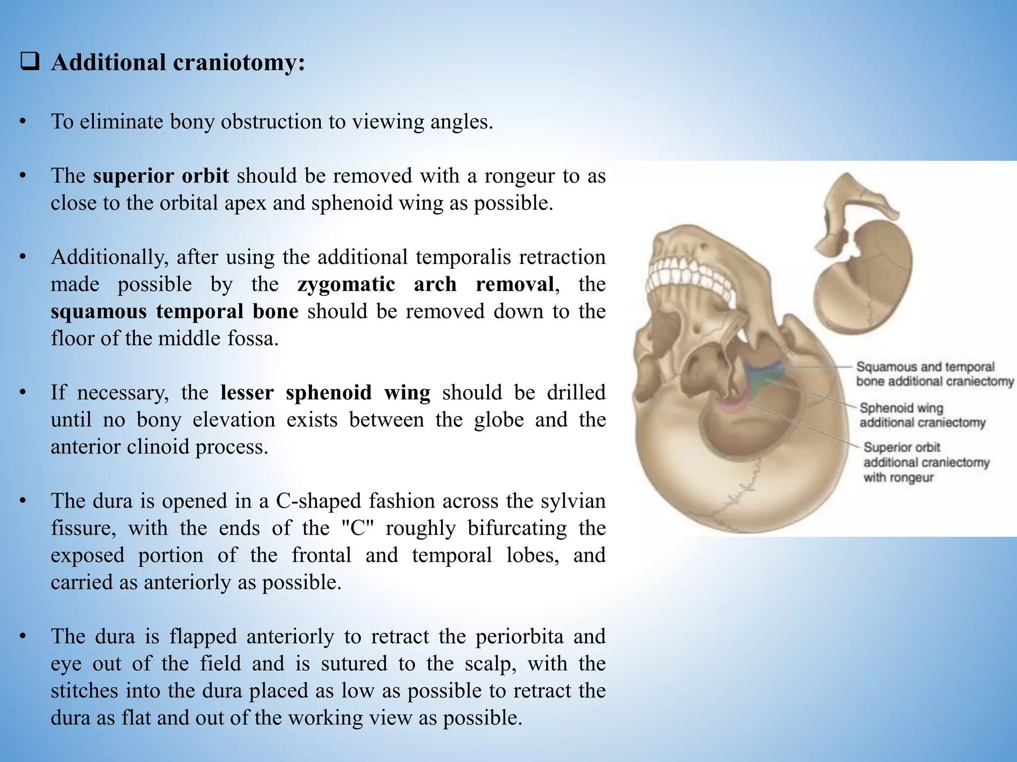 Frontotemporal FTOZ craniotomy | PPTX
