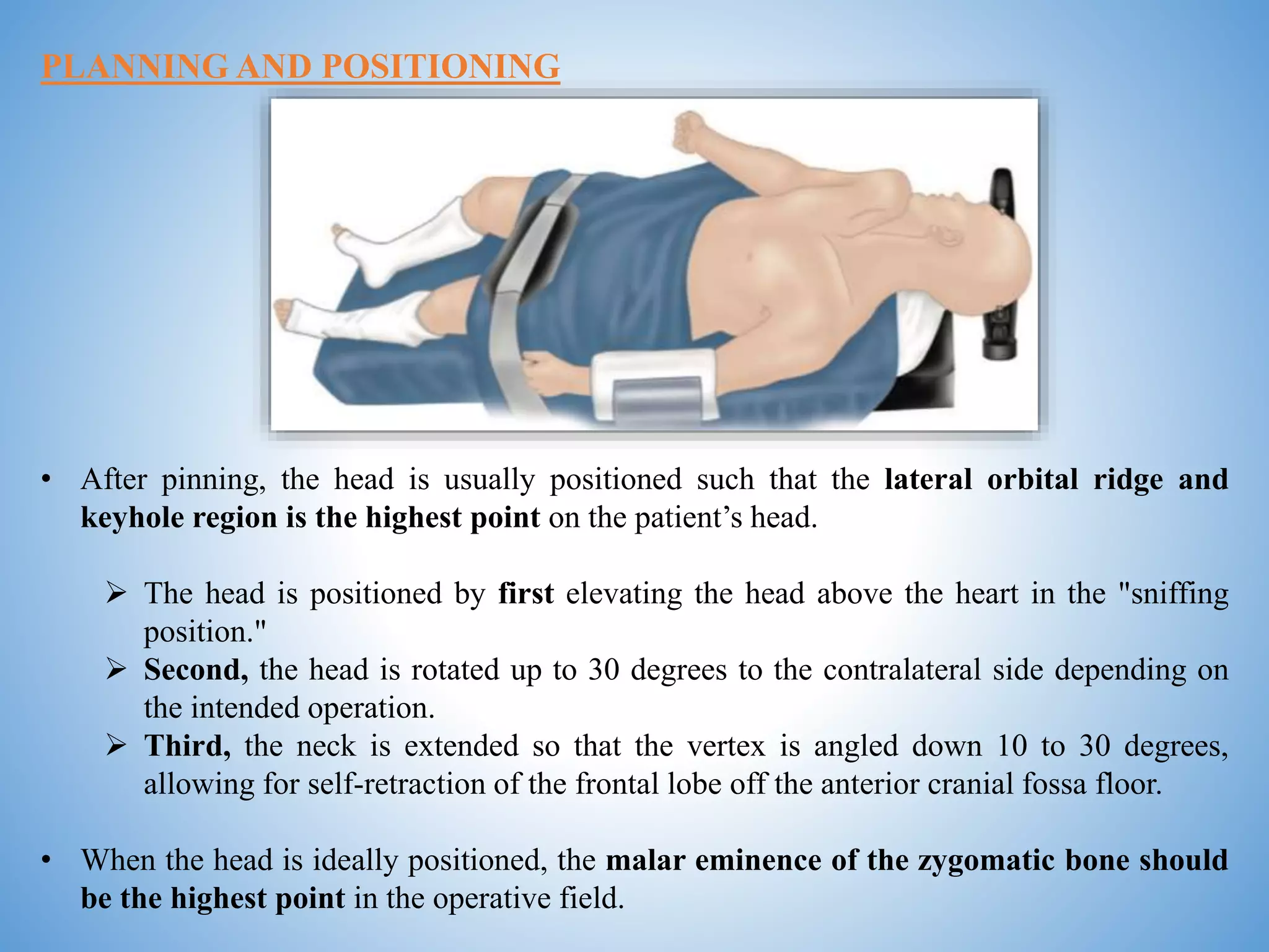Frontotemporal FTOZ craniotomy | PPTX