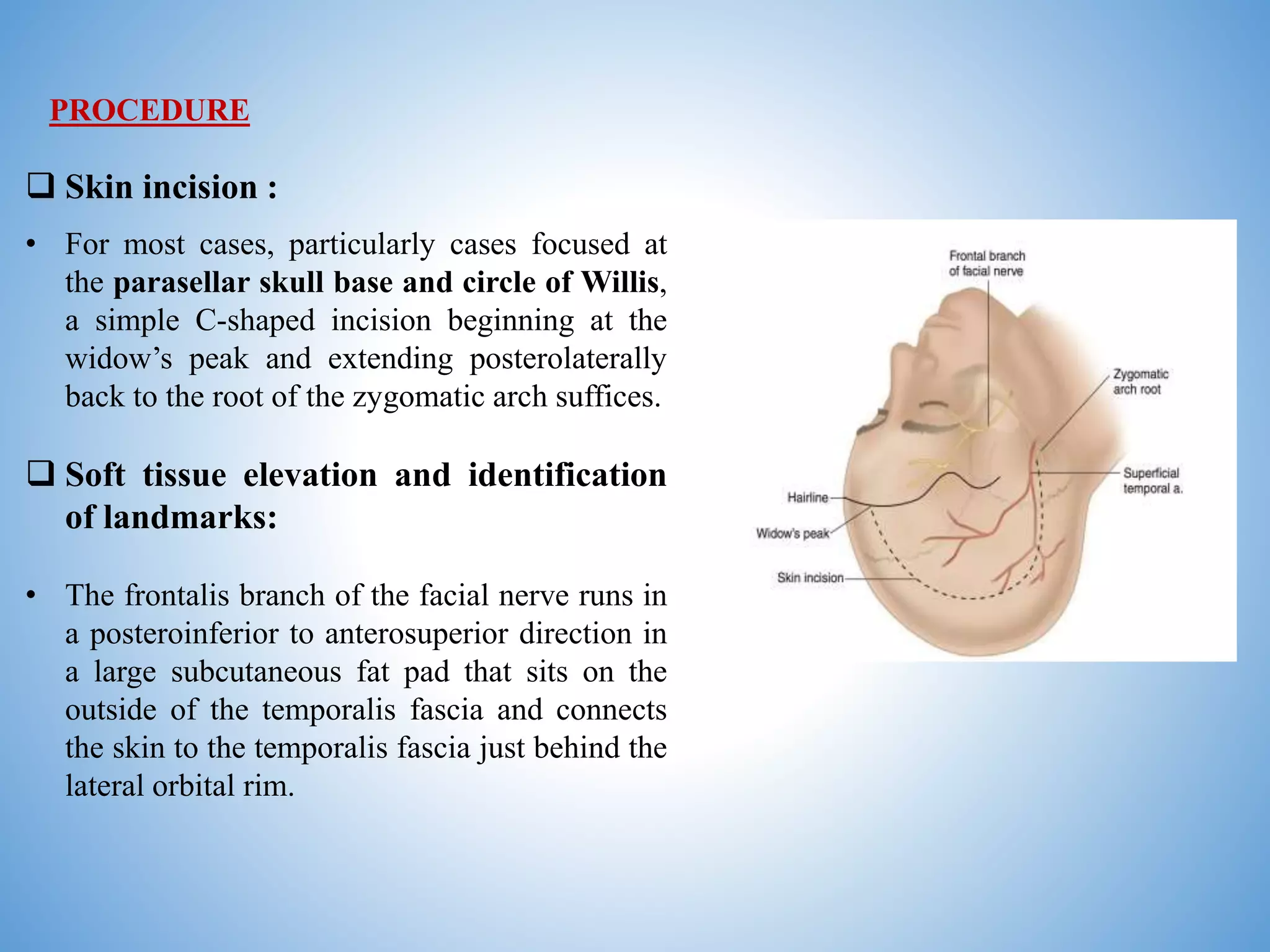 Frontotemporal FTOZ craniotomy | PPTX