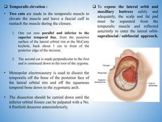 Frontotemporal FTOZ craniotomy | PPTX