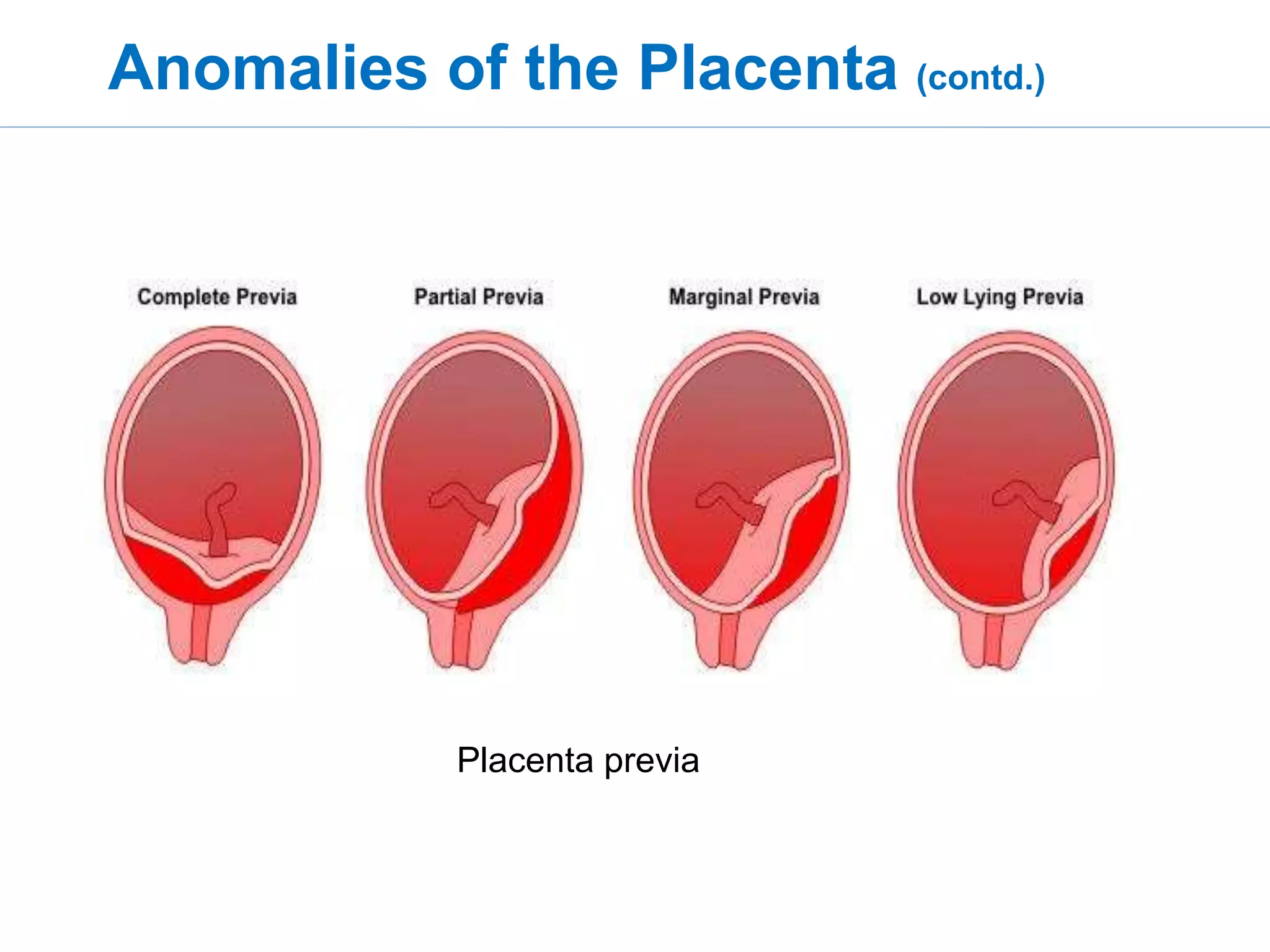Structure-function relationship of the placenta and its anomalies | PPTX