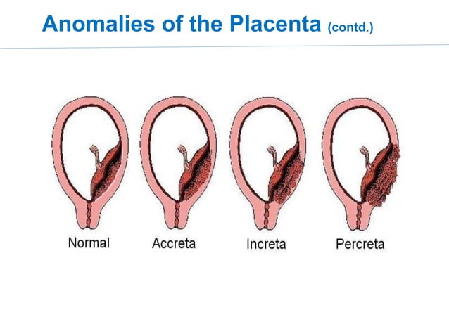 Structure-function relationship of the placenta and its anomalies ...
