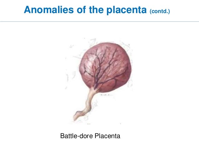 Structure Function Relationship Of The Placenta And Its Anomalies