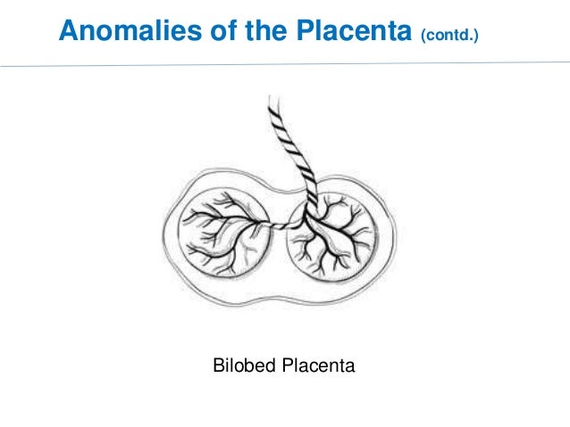 Structure Function Relationship Of The Placenta And Its Anomalies