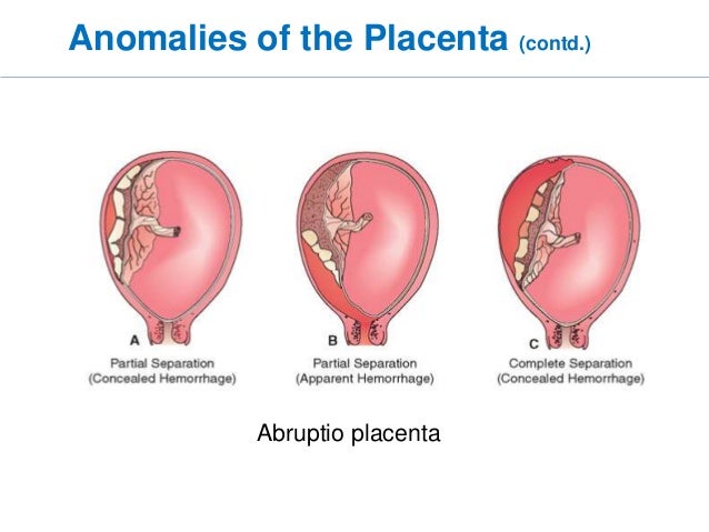 Structure-function relationship of the placenta and its anomalies