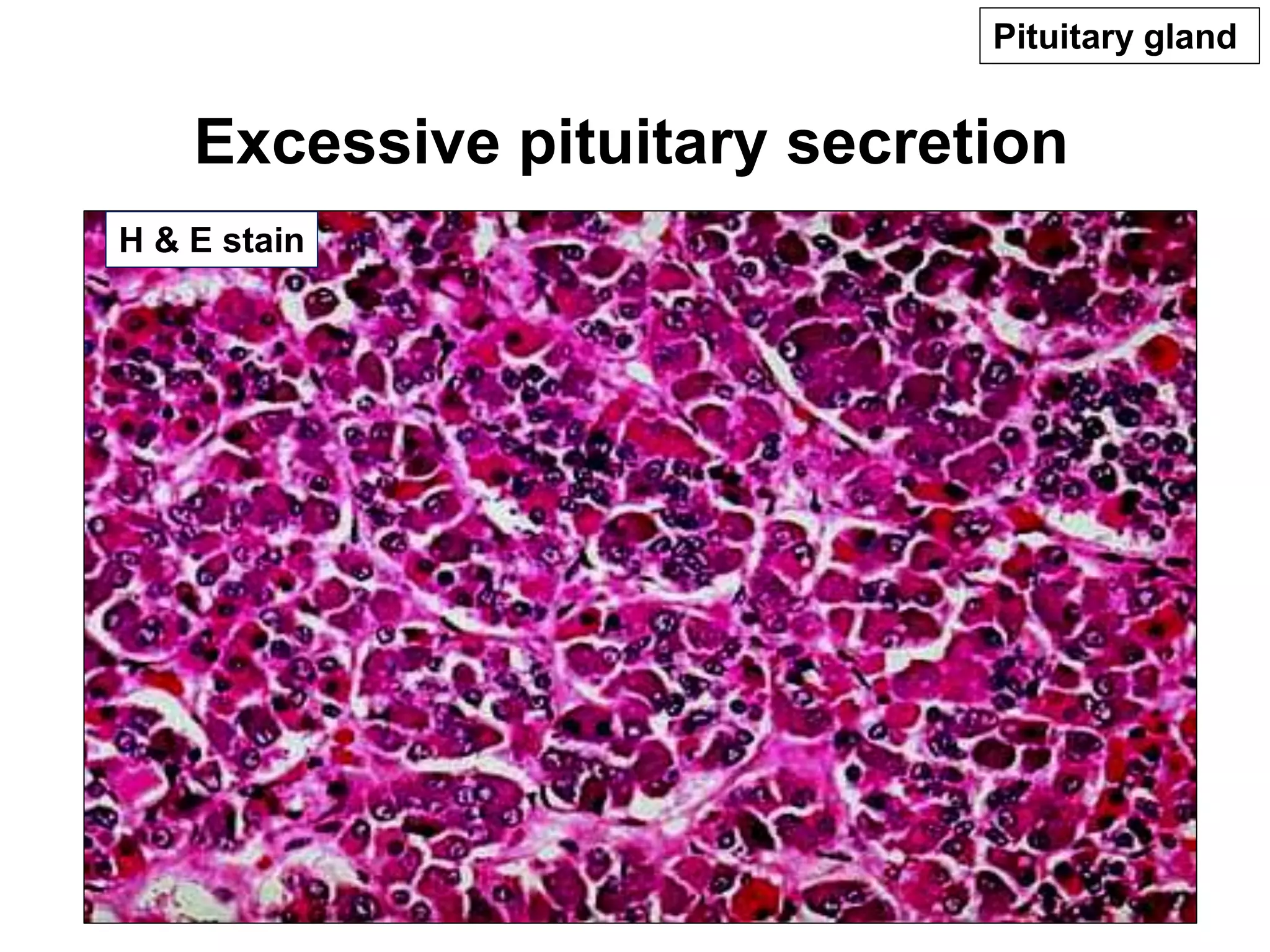Structure-Function Relationship of the Endocrine Glands of the Head and ...