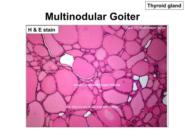 Structure-Function Relationship of the Endocrine Glands of the Head and ...