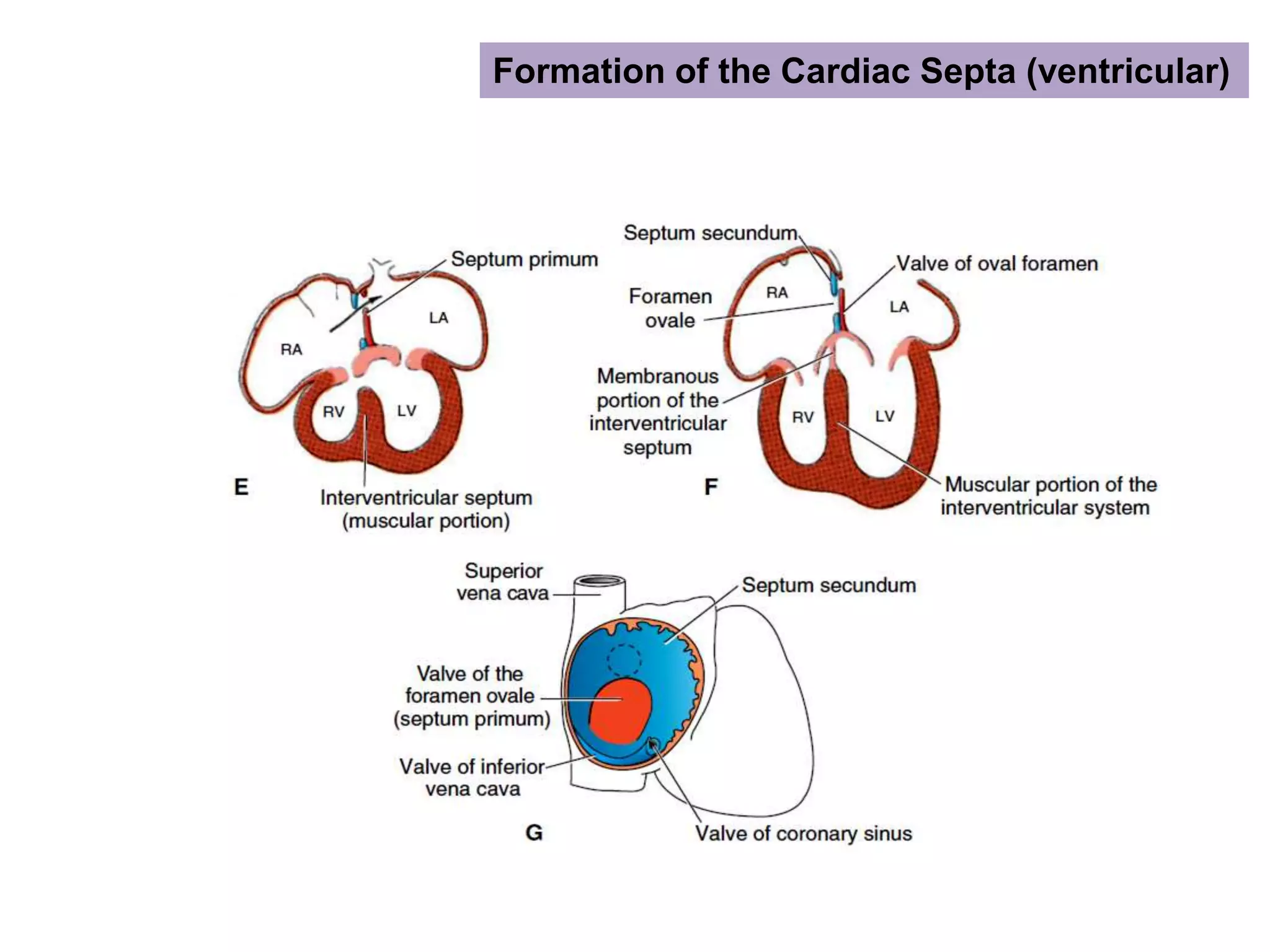 Development and Developmental Anomalies of the Heart | PPTX