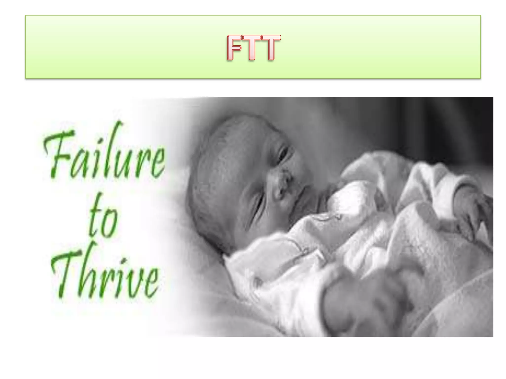 Approach to a child with failure to thrive | PPTX