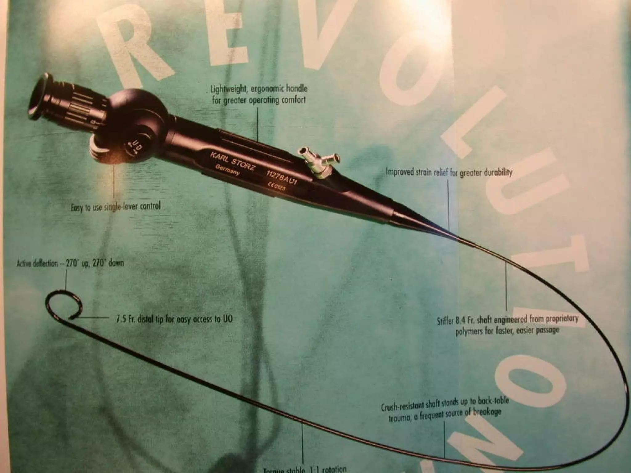 Retrograde Intrarenal Ureteroscopic Surgery (RIRS) | PPT