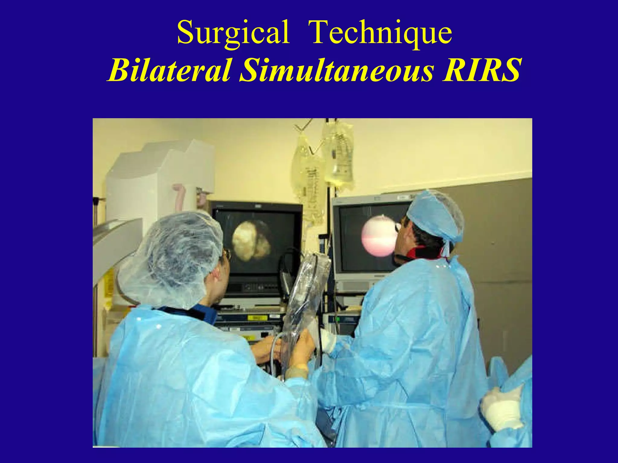 Retrograde Intrarenal Ureteroscopic Surgery (RIRS) | PPT