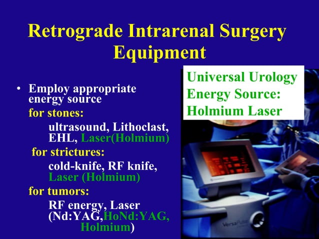 Retrograde Intrarenal Ureteroscopic Surgery (RIRS) | PPT