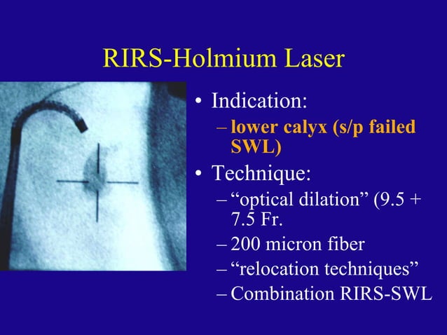 Retrograde Intrarenal Ureteroscopic Surgery (RIRS) | PPT