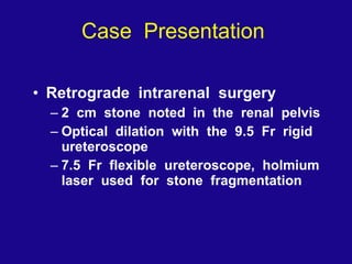 Retrograde Intrarenal Ureteroscopic Surgery (RIRS) | PPT