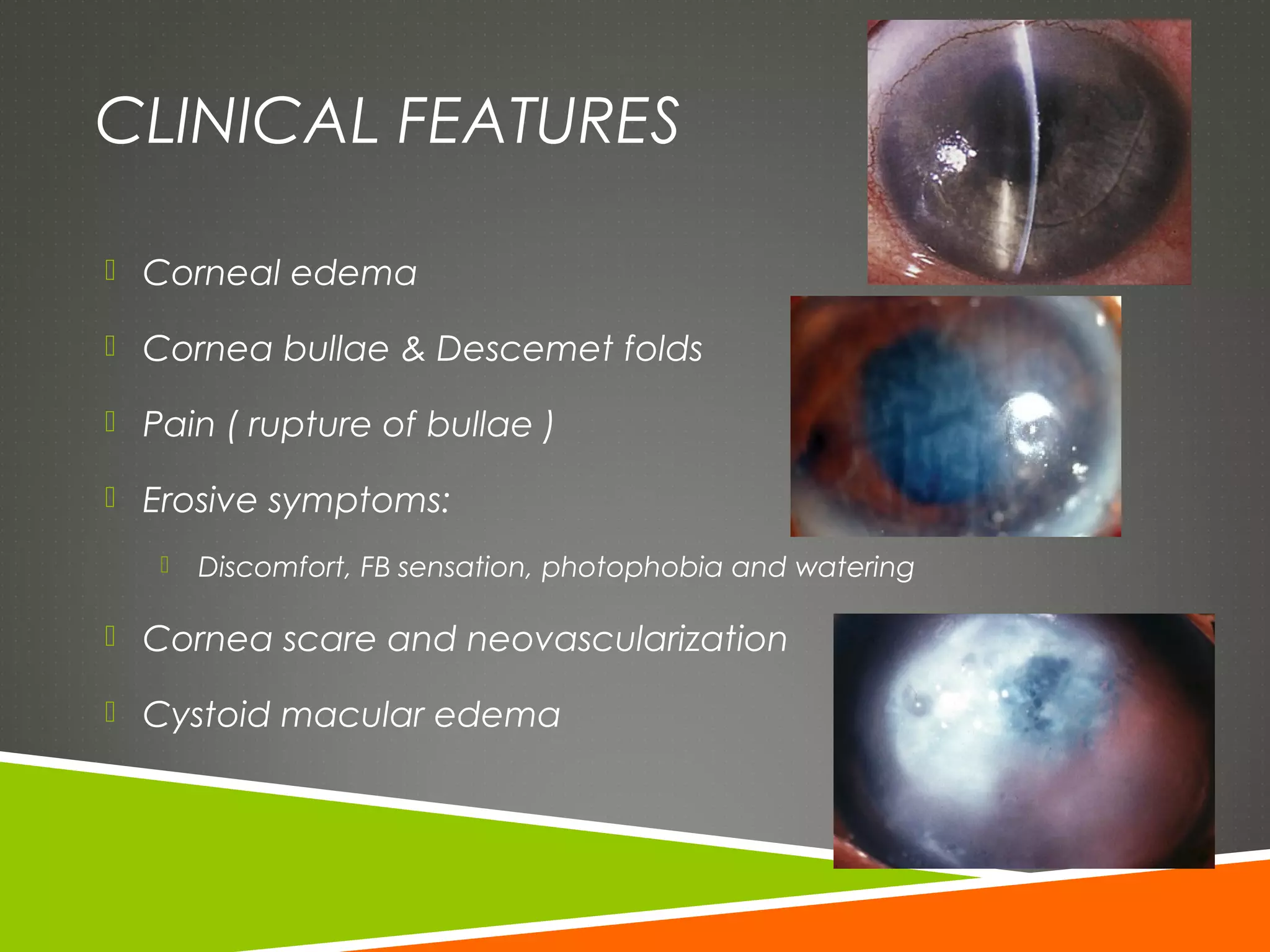 Fuchs dystrophy and pseudophakic bullous keratopathy | PPT