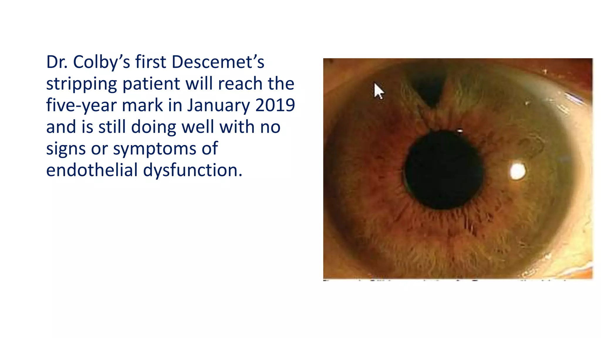 Fuchs Endothelial Dystrophy Mahfuz Pptx