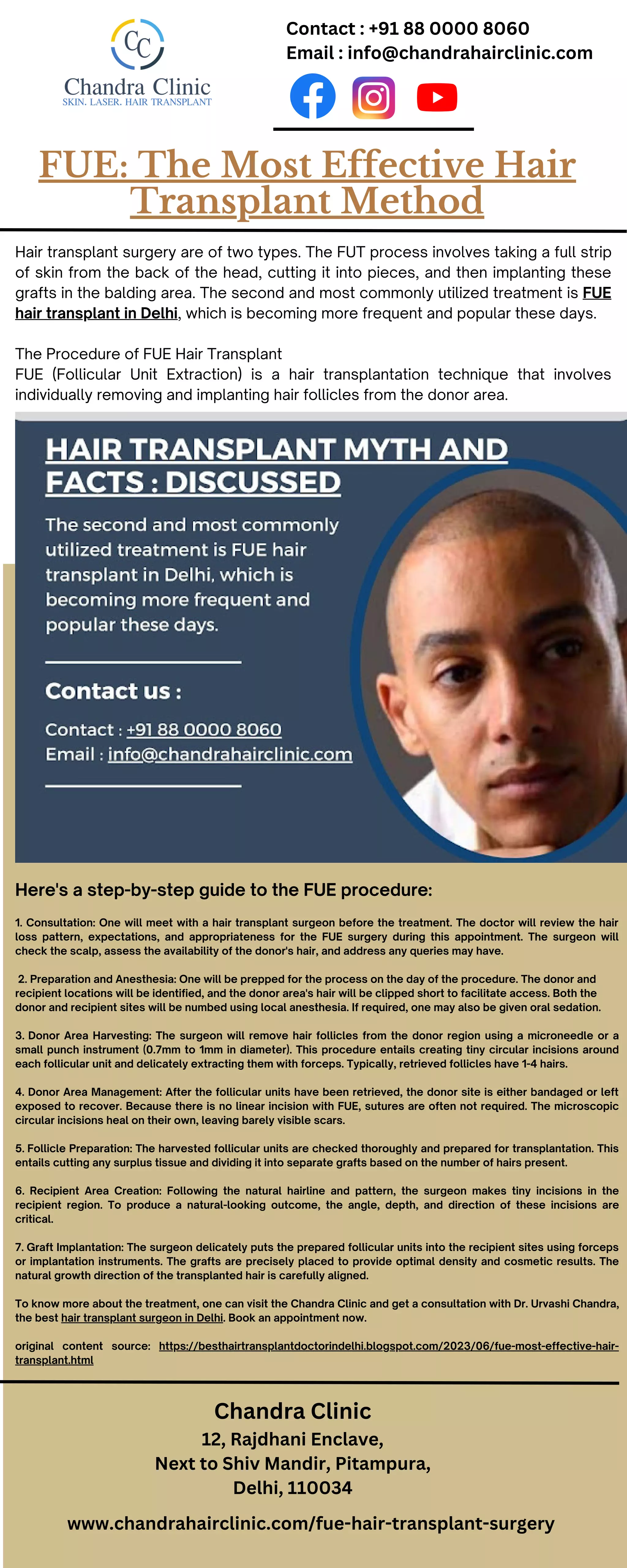 FUE Hair Transplant in Delhi - The Most Effective Hair Transplant ...