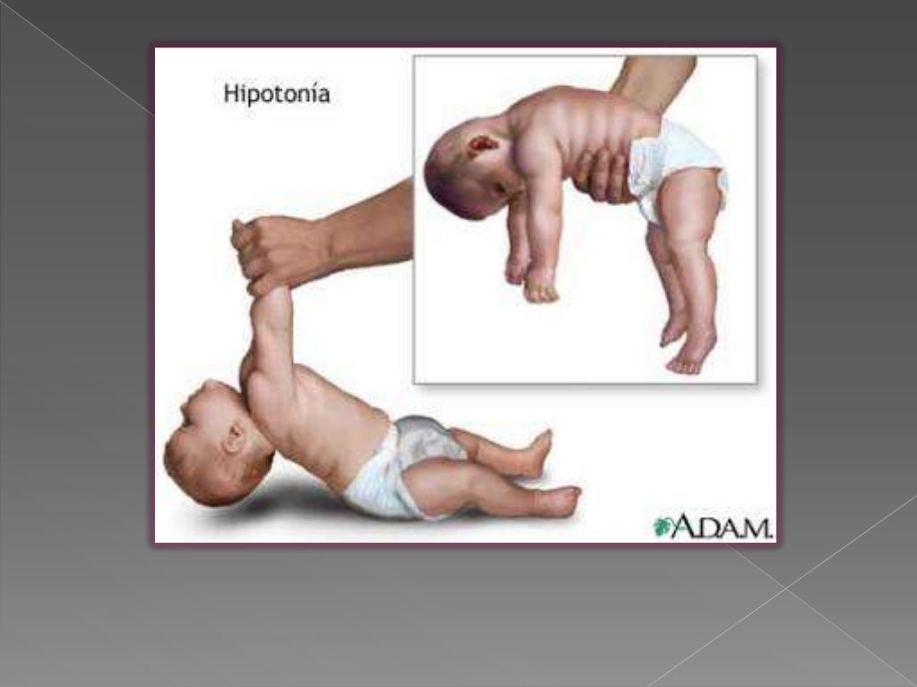 Fuerza y tono Muscular