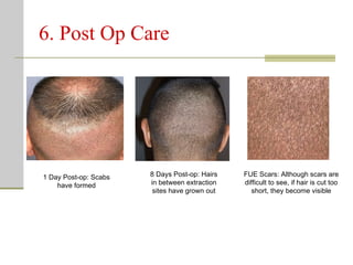 Fue surgical assistant's role | PPT