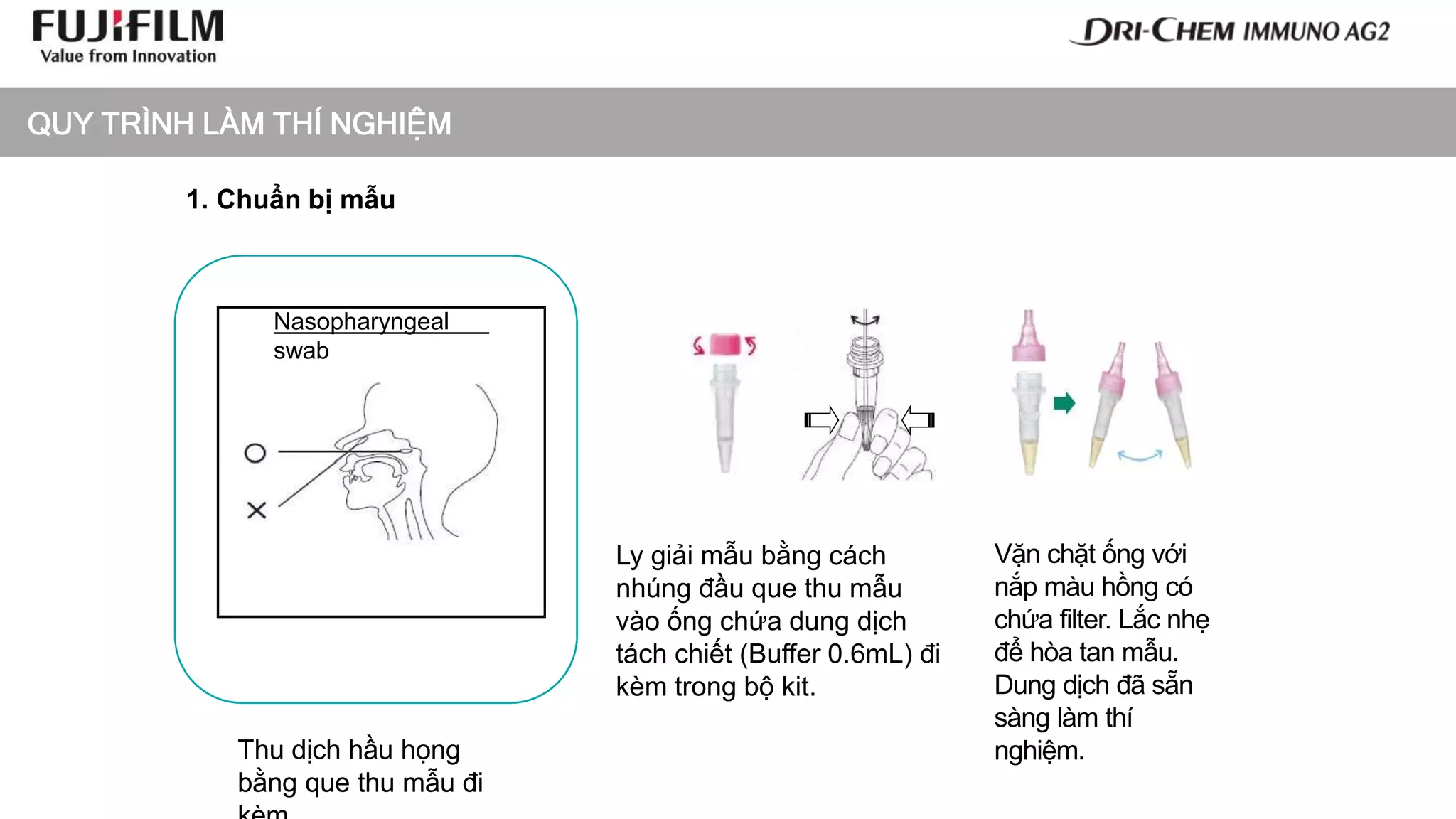 FUJIFIM_FDC_PRODUCTS OVERVIEW.pptx