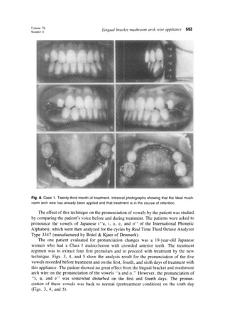 Fujita lingual orthodontics ajo article | PDF