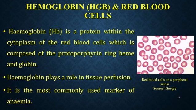 Full Blood Count (FBC) Interpretation.pptx | Blood Disorders | Diseases ...
