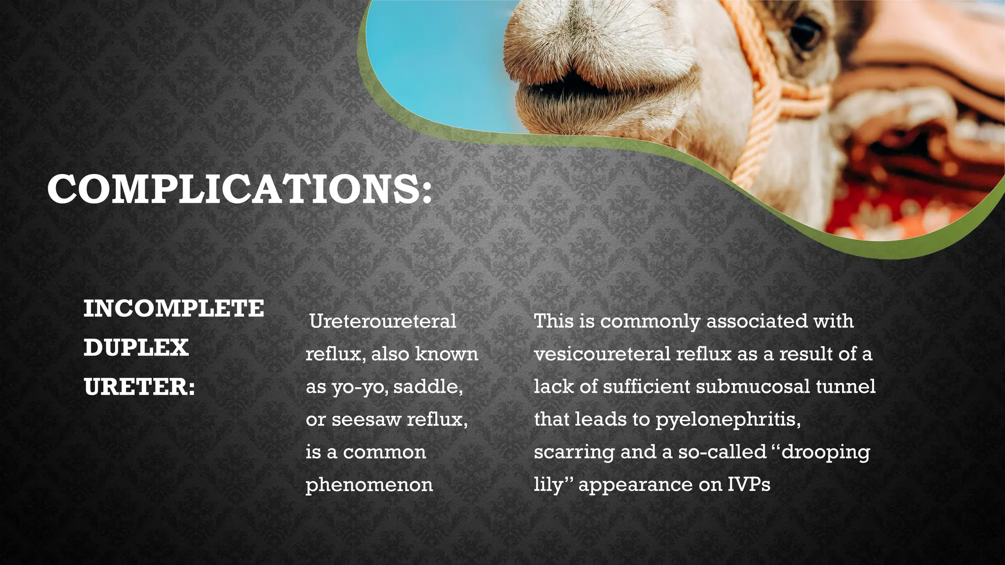 Duplex renal systemComplete/Partial Duplex Renal System, .pptx
