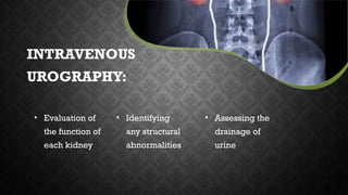 Duplex renal systemComplete/Partial Duplex Renal System, .pptx