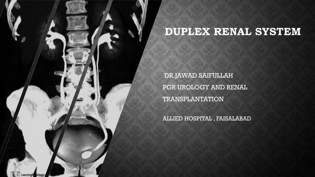 Duplex renal systemComplete/Partial Duplex Renal System, .pptx