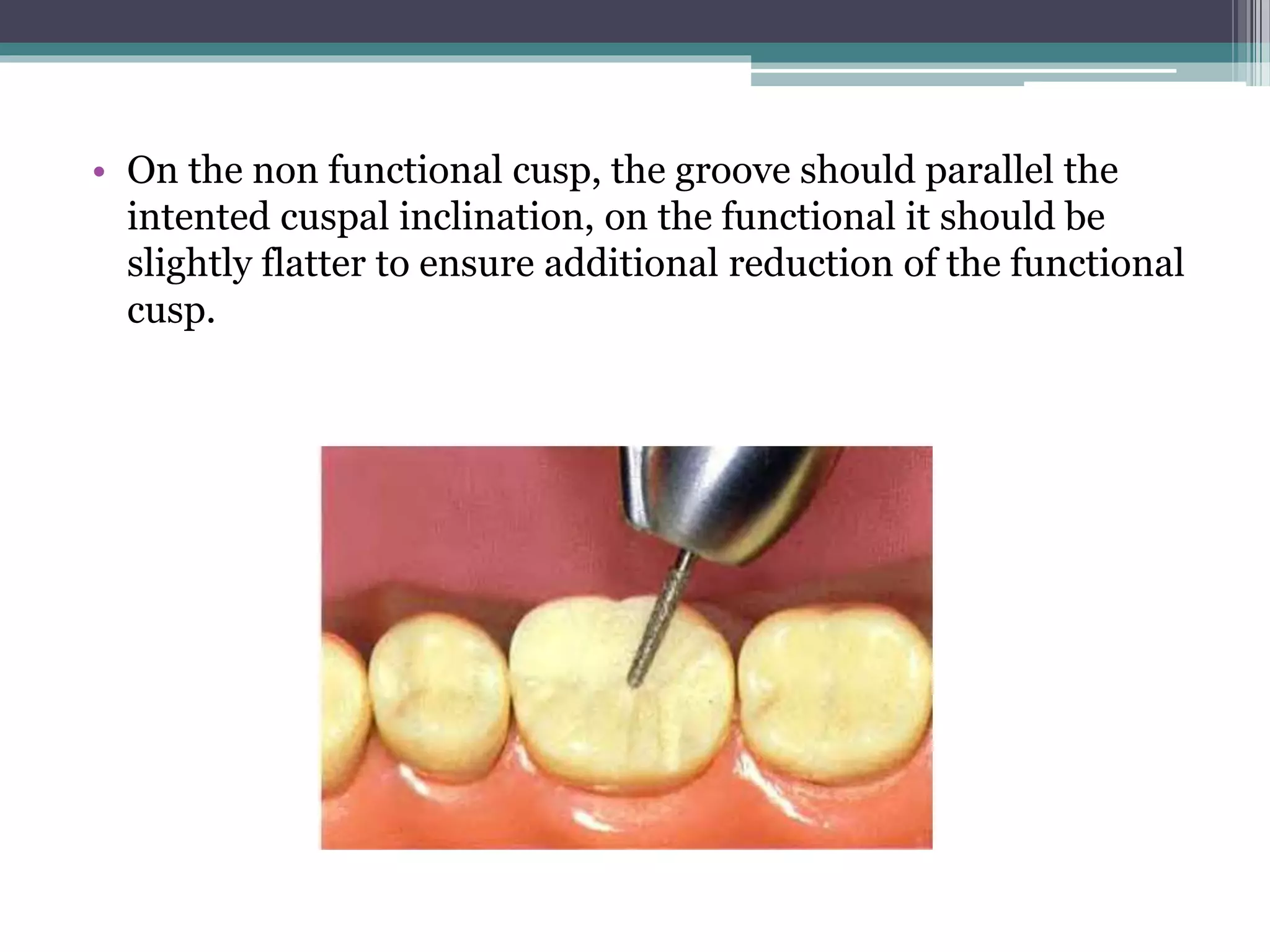 full coverage restorations.pptx