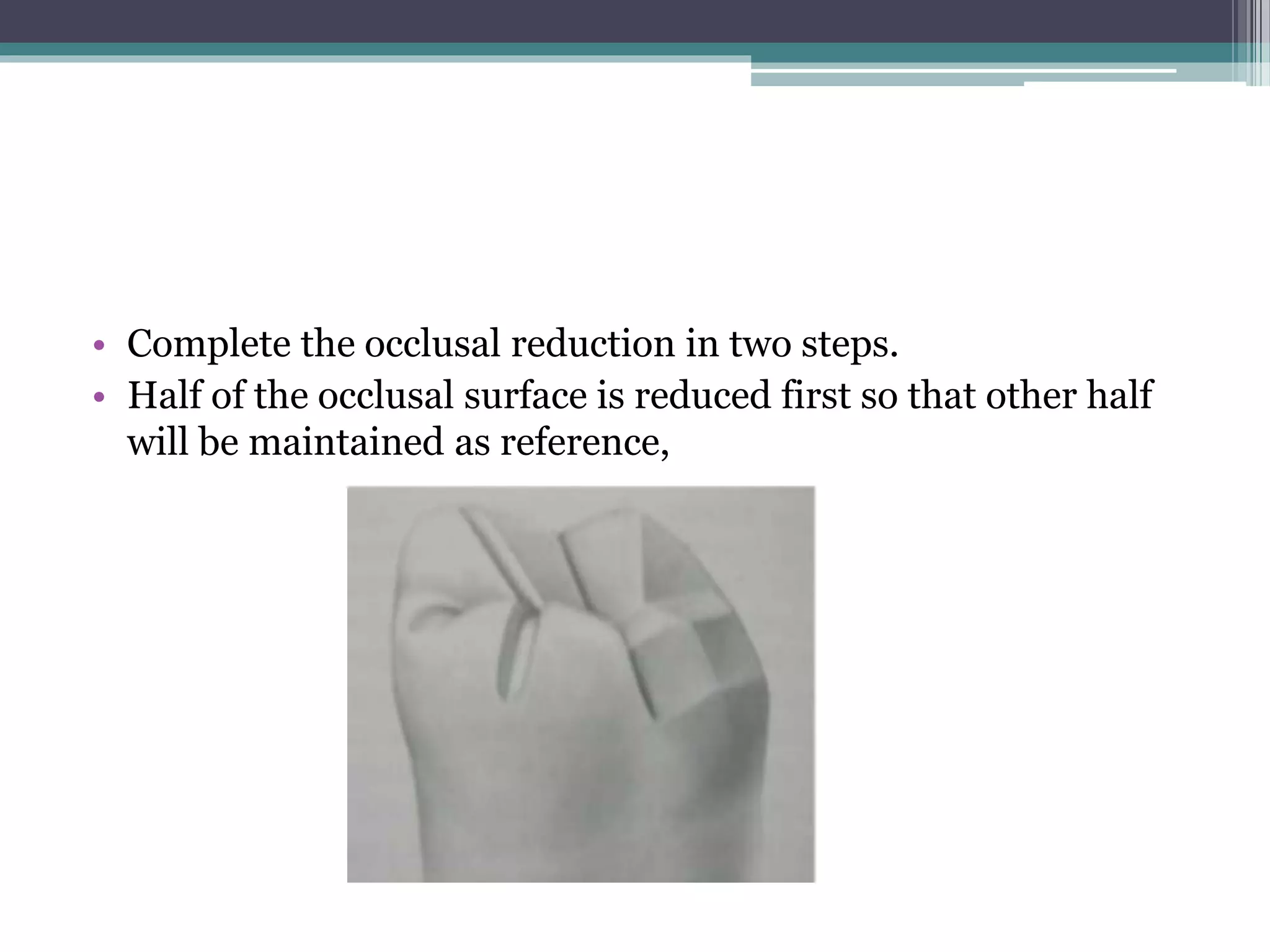 full coverage restorations.pptx