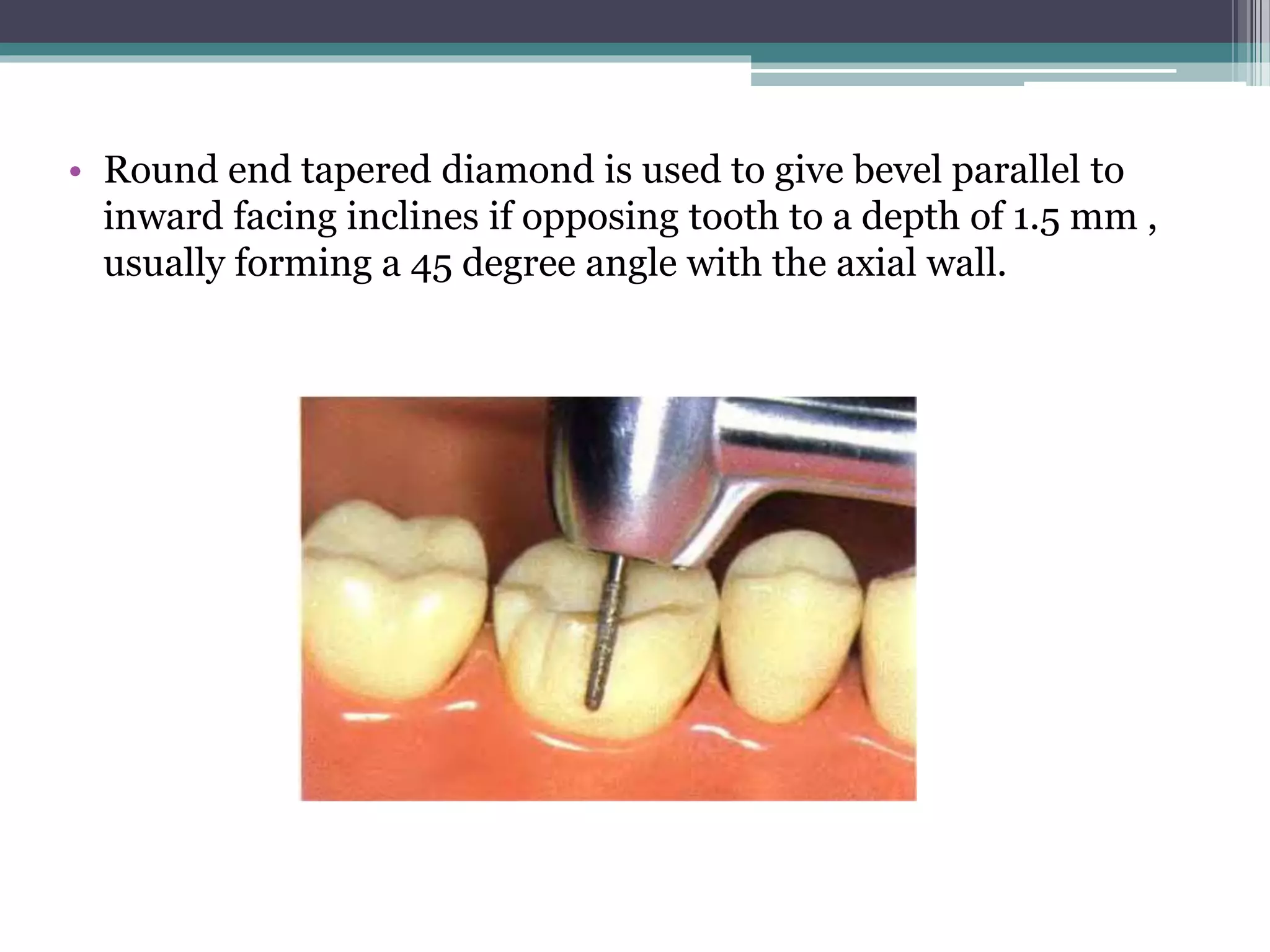 full coverage restorations.pptx