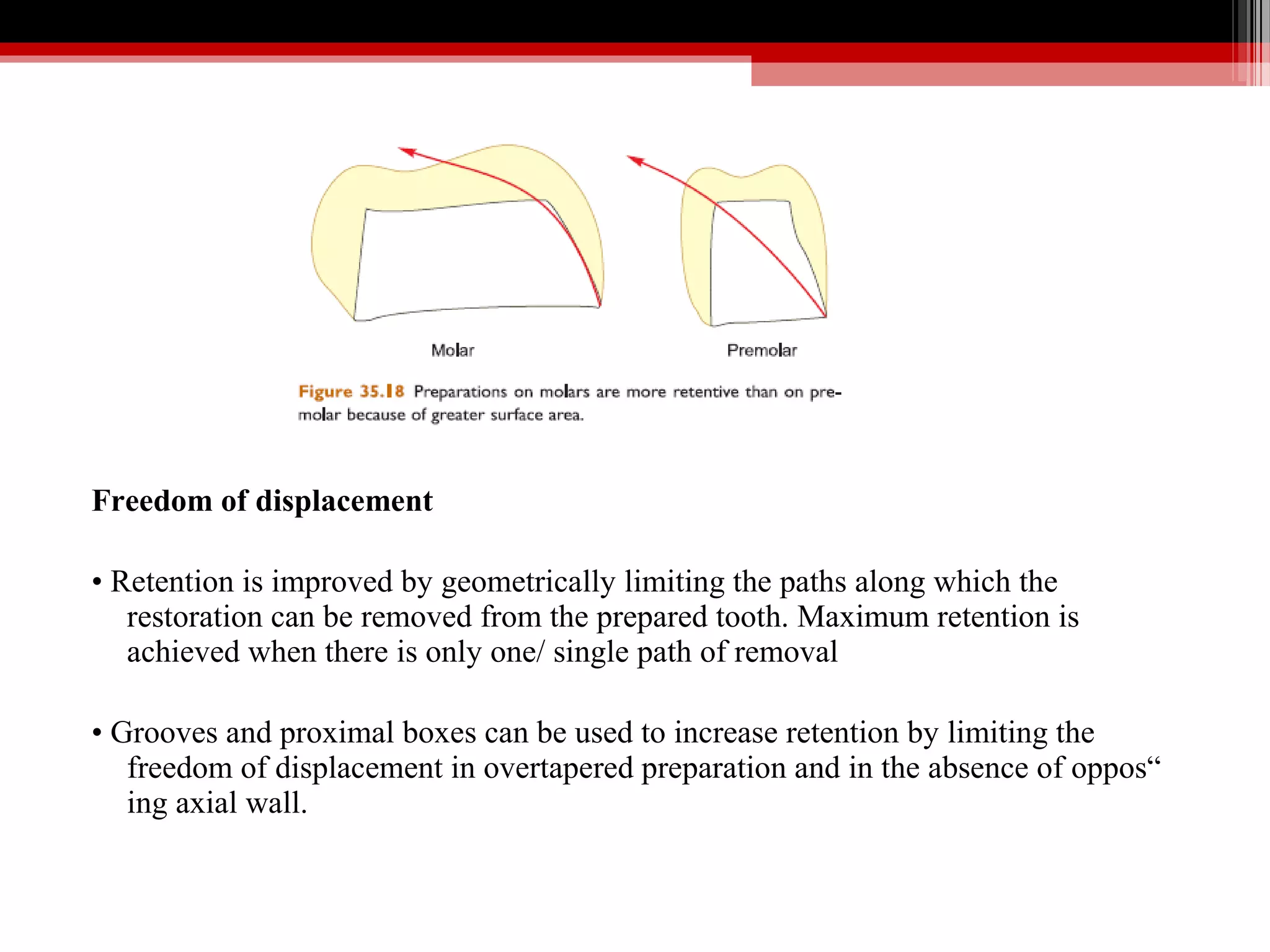 Full crown preparation | PPT