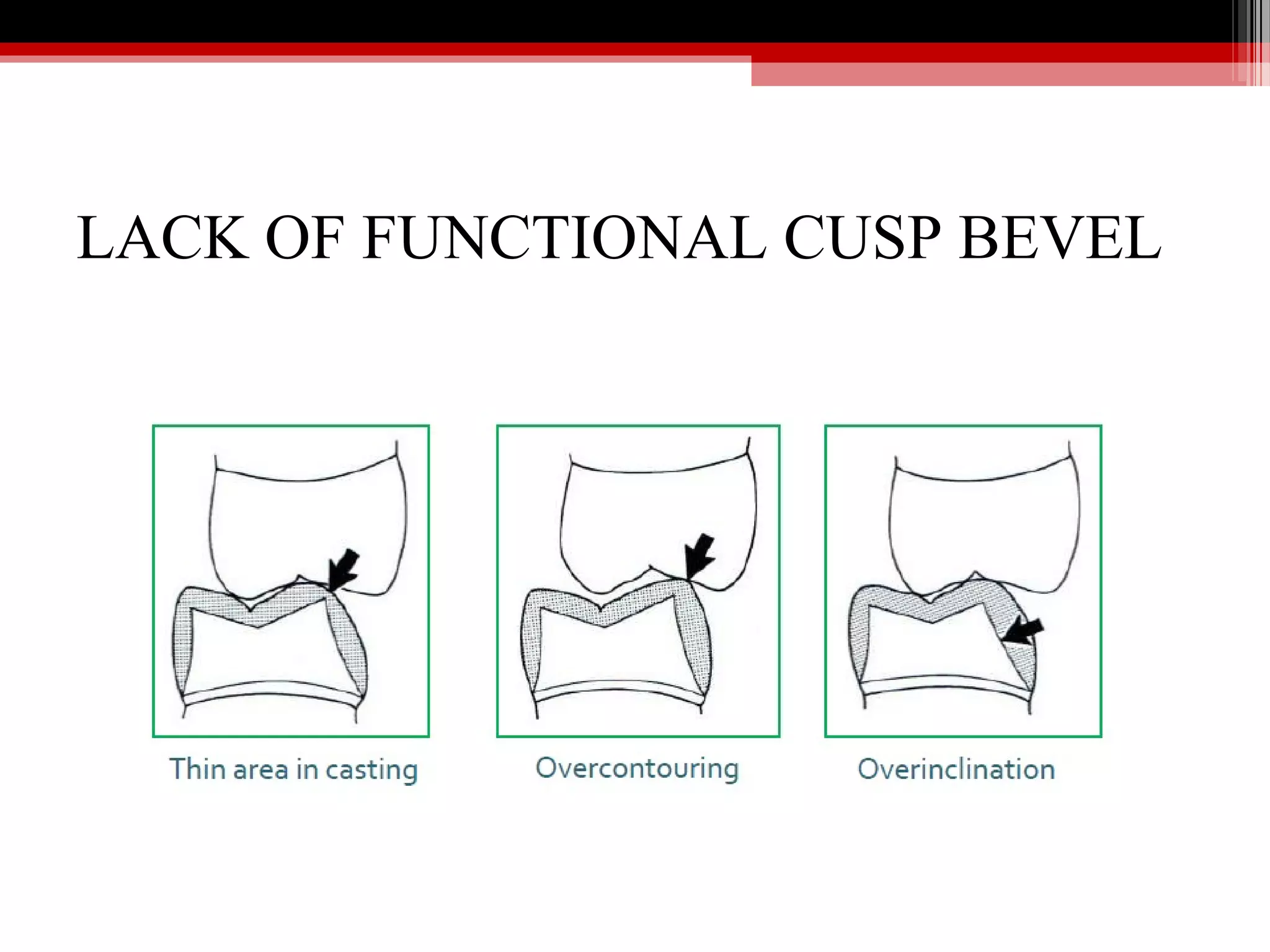 Full crown preparation | PPT