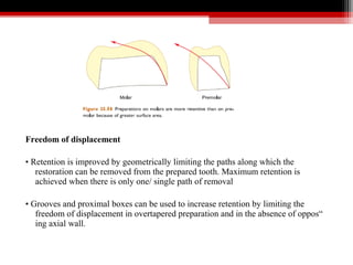 Full crown preparation | PPT