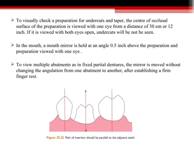 Full crown preparation | PPT | Dental Health | Diseases and Conditions