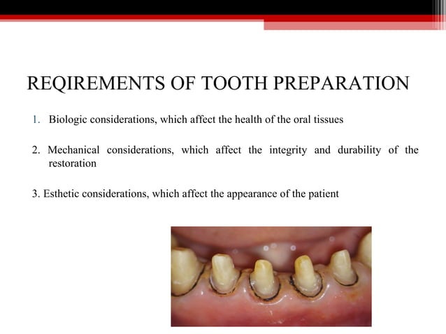 Full crown preparation | PPT | Dental Health | Diseases and Conditions