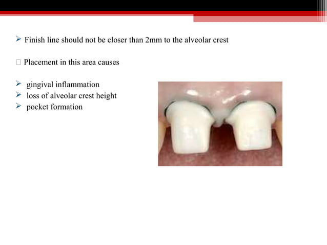 Full crown preparation | PPT | Dental Health | Diseases and Conditions