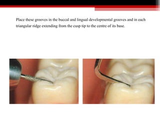 Full crown preparation | PPT