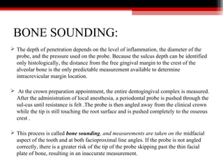 Full crown preparation | PPT